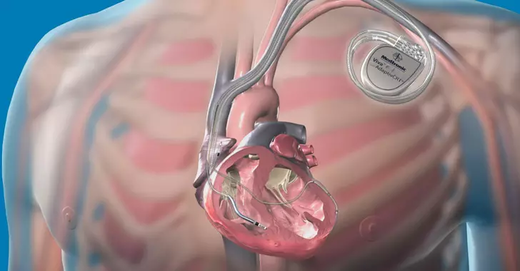 medtronic implantable defibrillators හැක් කිරීම