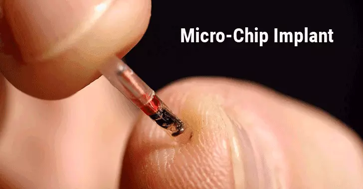 dräi-Quadrat-Maart-Mikrochip-Implantat
